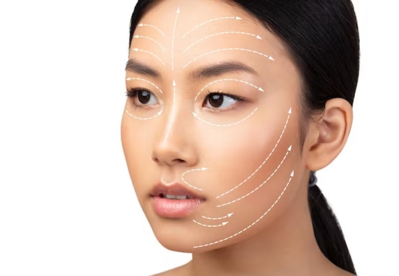 Căng da mặt bằng chỉ Collagen giá bao nhiêu: Bảng giá ưu đãi 2024 - Dr ...